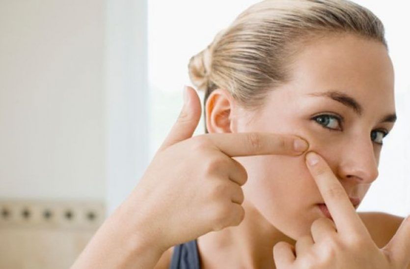 La mejor forma de apretar una espinilla, mejor visita a un dermatologo