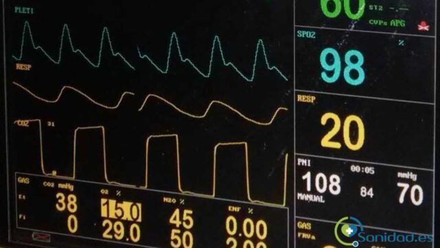 Todo sobre la importancia de la capnografía en la medicina | Sanidad.es
