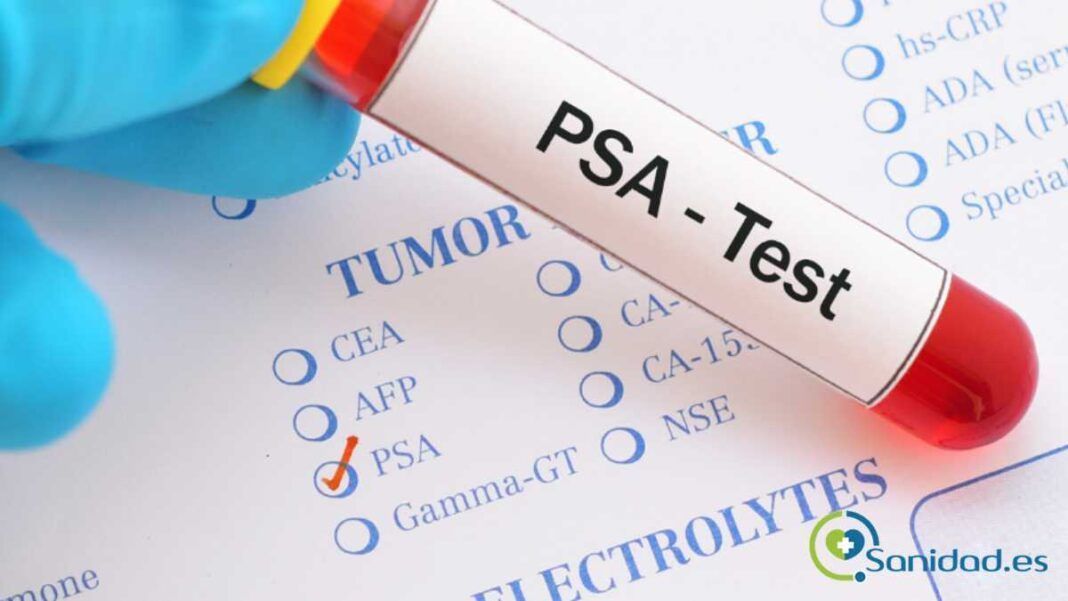 Todo lo que debes conocer sobre el examen de próstata | Sanidad.es