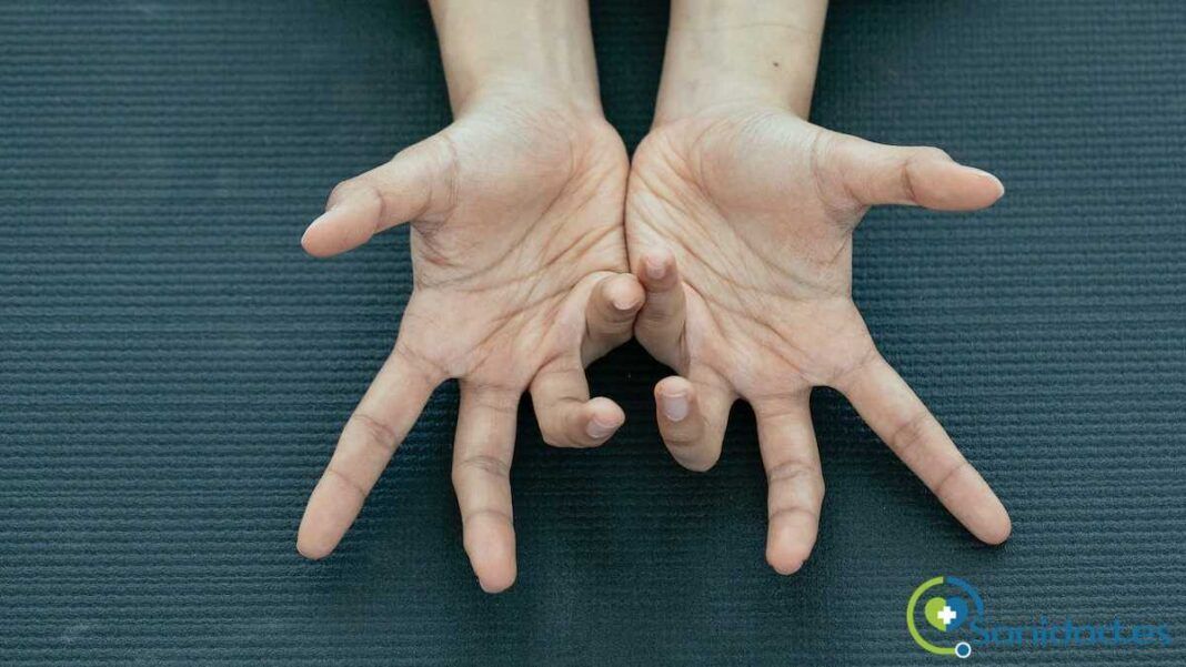Primeros Auxilios para Convulsiones: cómo actuar ante una epilepsia